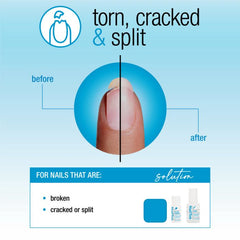 Nail Repair System ƒ?? Fix & Reinforce Nails | Nail Tek